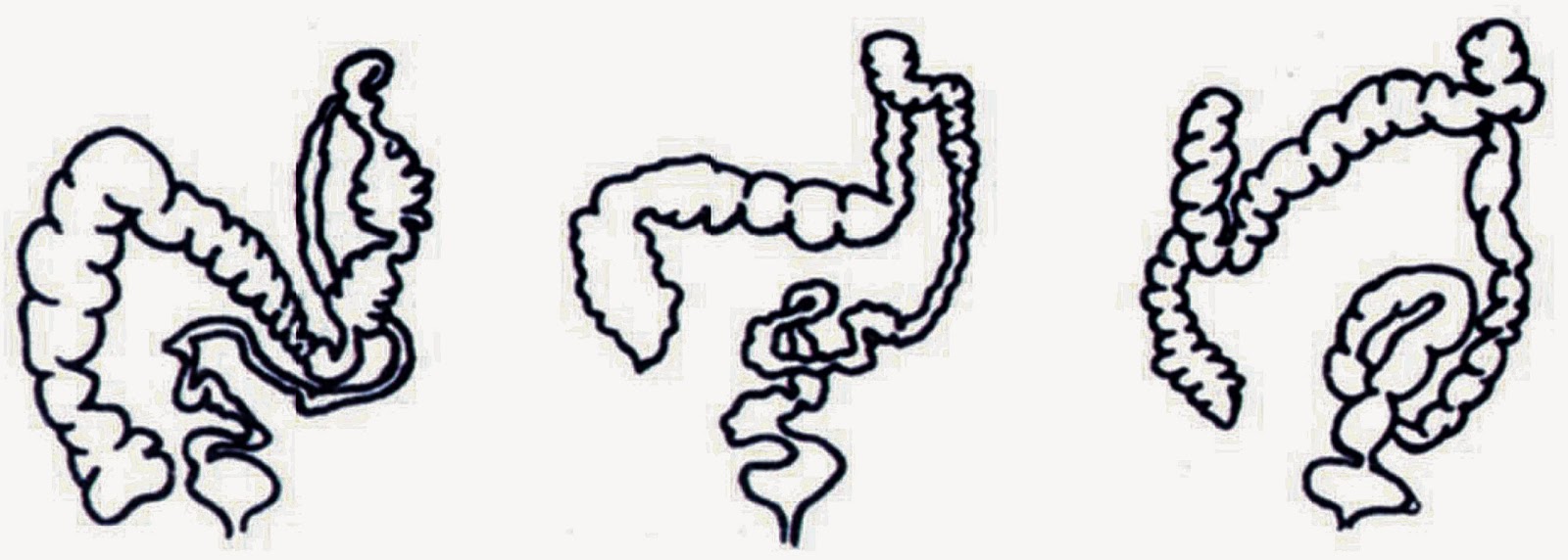 dorinte verzi: postul şi irigările colonice