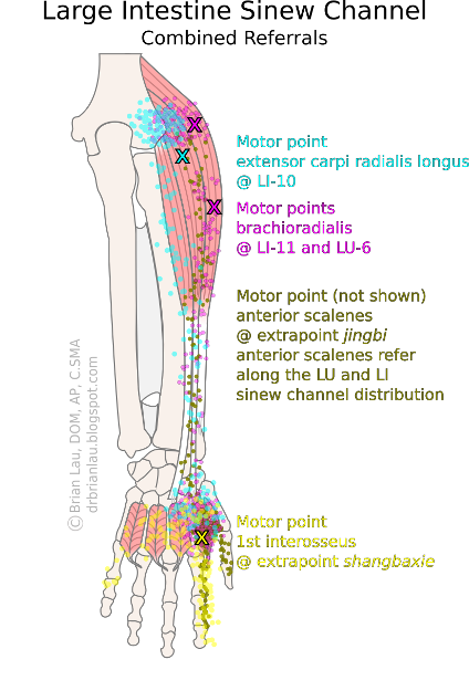 Anatomy of the Sinew Channels: Osteoarthritis of the Hand and the Large ...