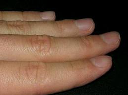 Hairs On Second Phalange of Ring Finger Palmistry ~ INDIAN PALMISTRY ...