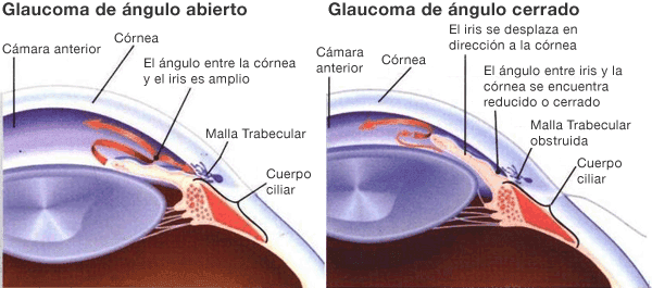 Blog De Optica Conforvision Semana De PrevenciÓn Del Glaucoma