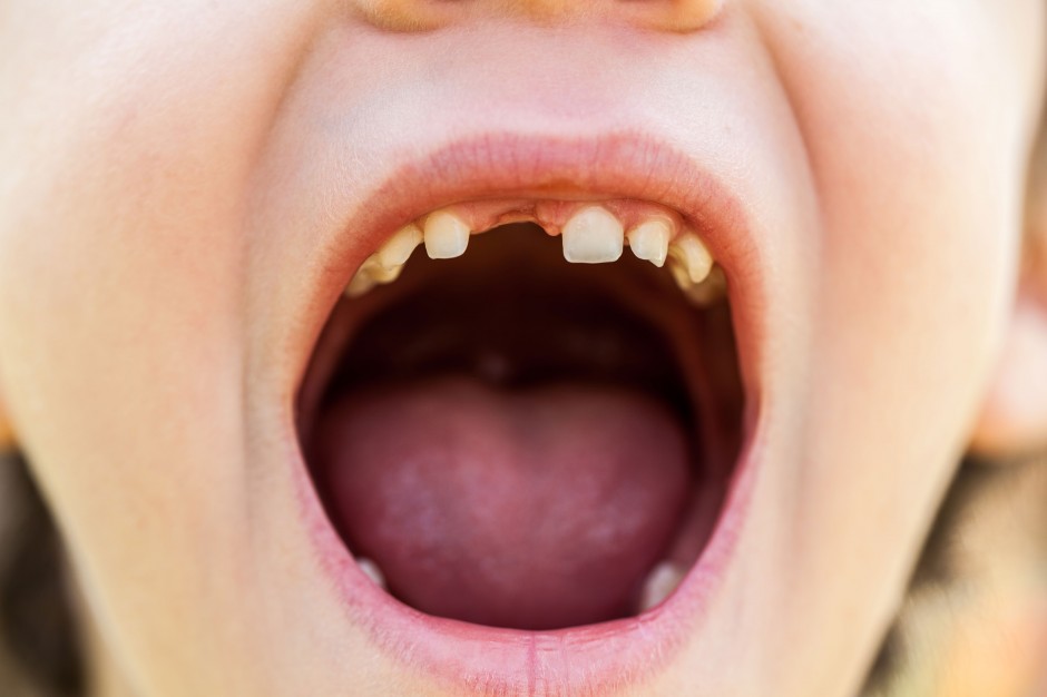 ANWA Founder & Friends: Big-People Teeth