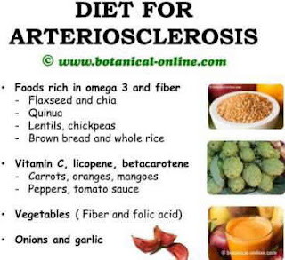 Atherosclerosis: Dietary Treatment for Atherosclerosis