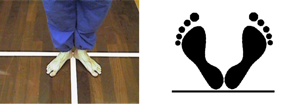 Back to basics: stances