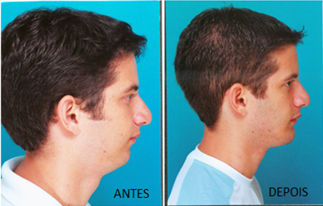 Ortodoncia Basada en Evidencias