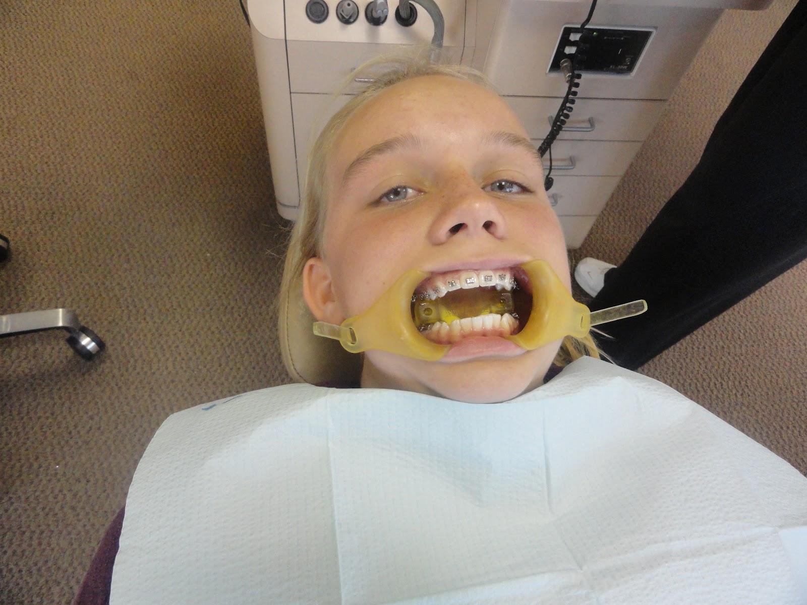 Splan/ Sullivan Spotlight: Home Updates, Homecoming, Braces!