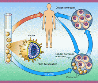Enfermedad Cerebrovascular