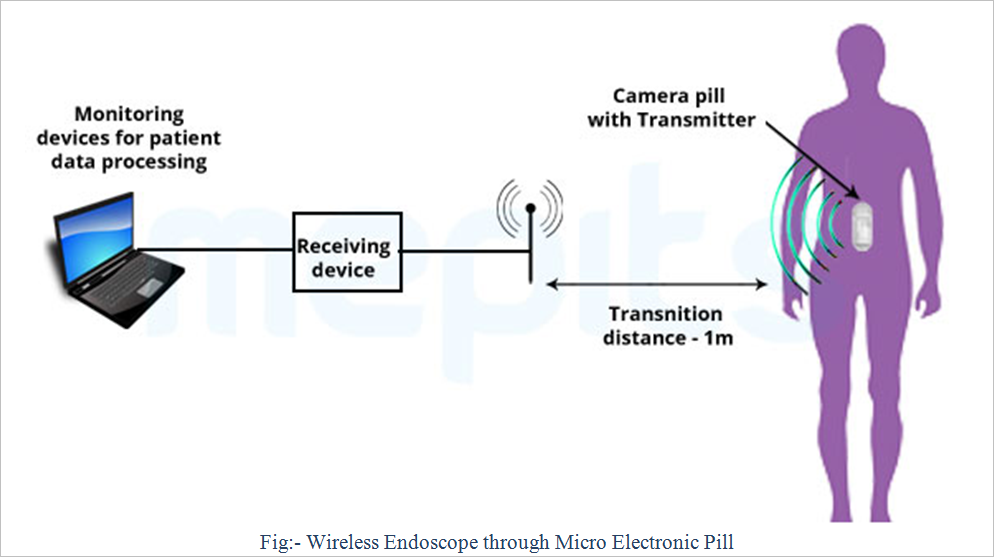 Bhargava: Micro electronic pill seminar report