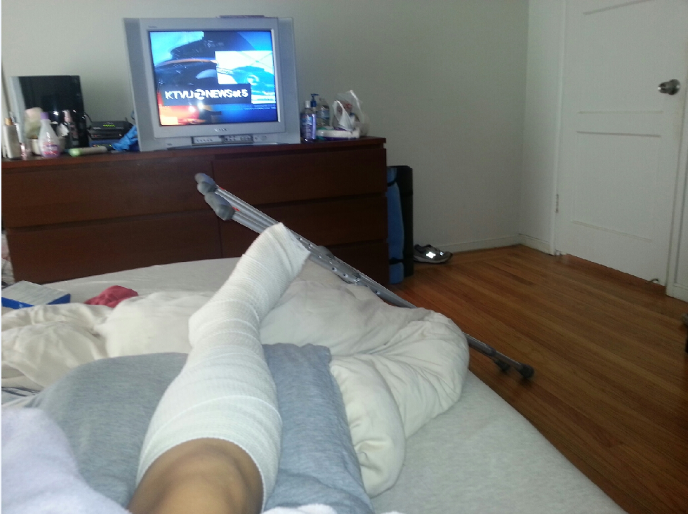 My Broken Ankle =(: ER - Broken ankle, fractured heel, dislocated, and ...