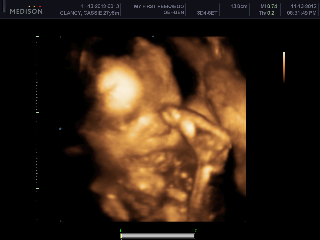 California Clancys: 28 weeks! 3D ultrasound!