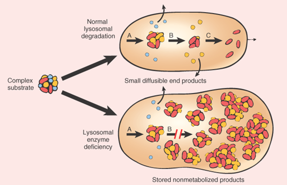 Pathology Outlines - Lysosomal storage diseases