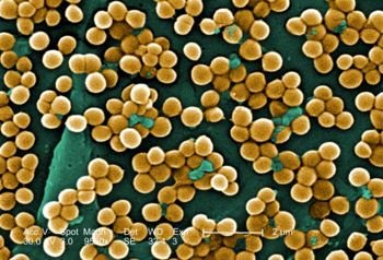 Tangents: Staphylococcus aureus bacteremia