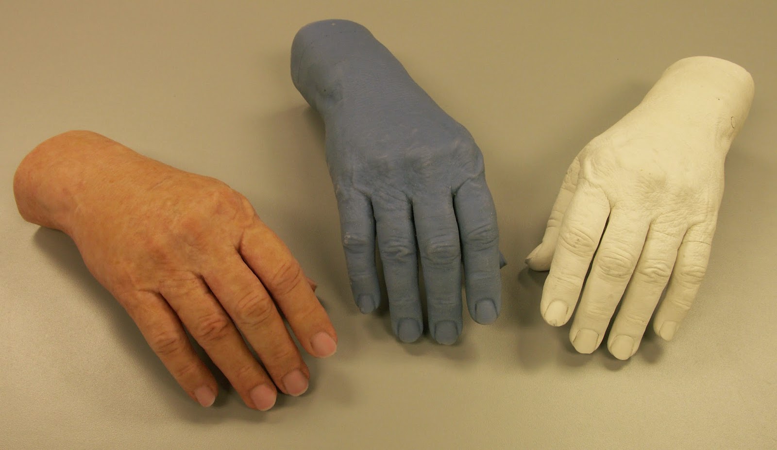 Direct Dimensions, Inc. Blog: Prosthetic Limbs Created With 3D Scanning ...