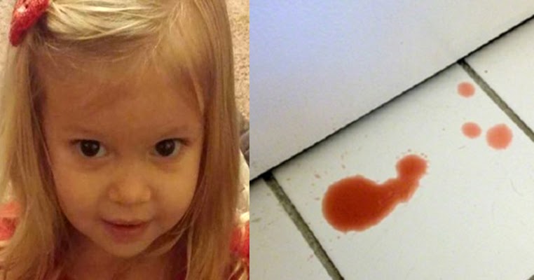 Turns Blue And Vomits Blood - Doctor Now Warn After Tragic Death ...