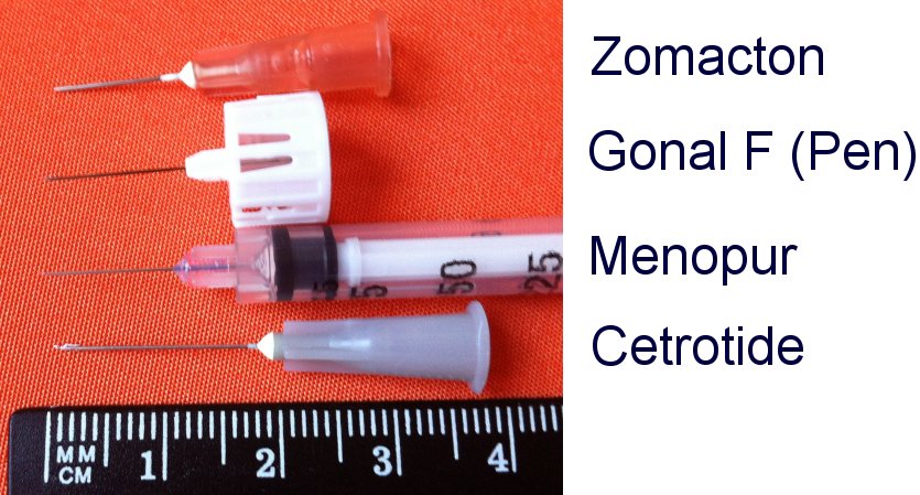 TCS PGD IVF: Needle sizes