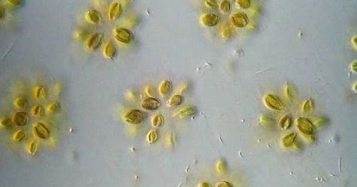 Golden Algae, Yellow-Green Algae, and Diatoms ~ Transforming the World