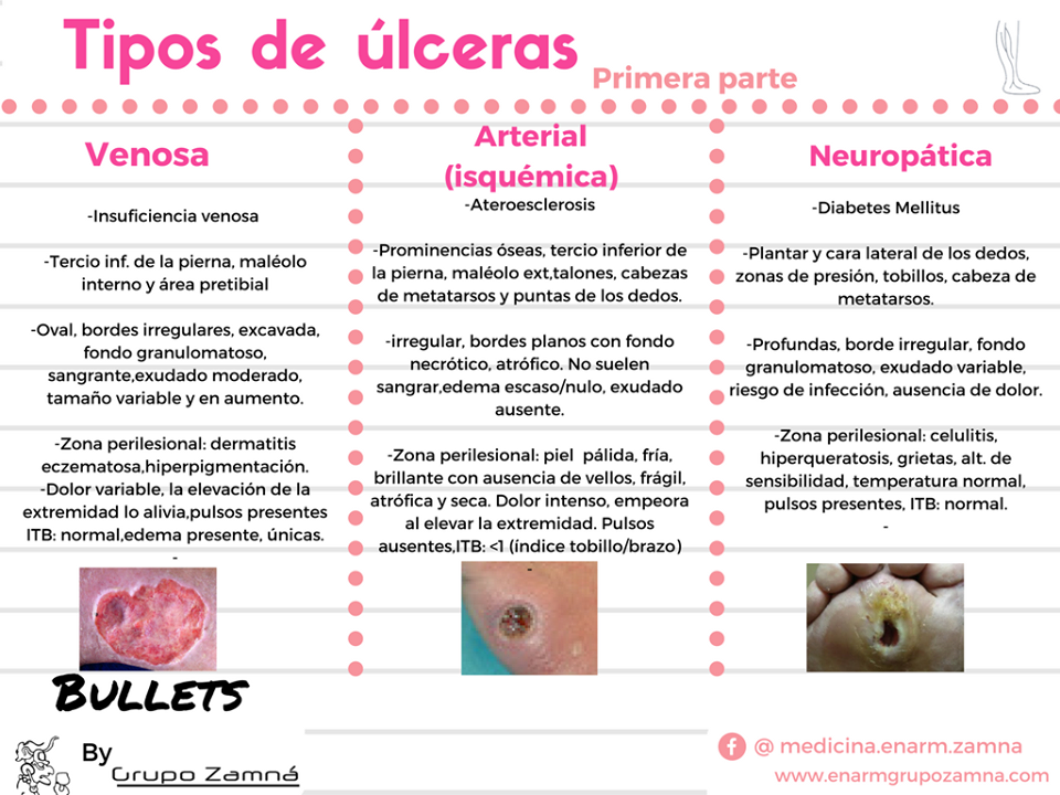 tipos de ulceras