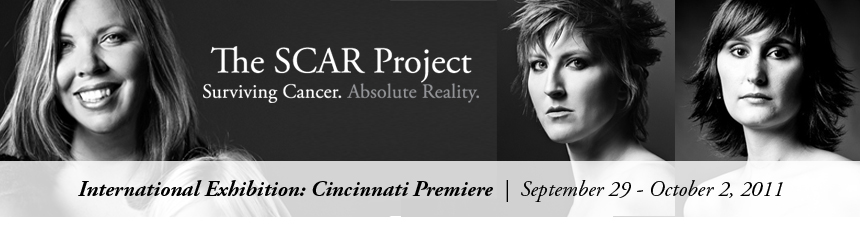 The SCAR Project [Cincinnati]: Jolene's Story