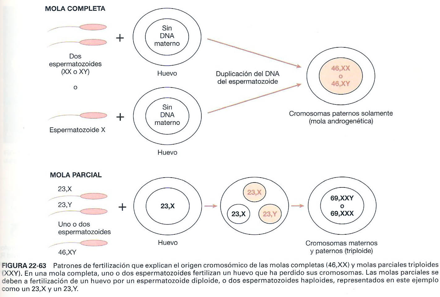 Andrea Silva: Mola hidatiforme.