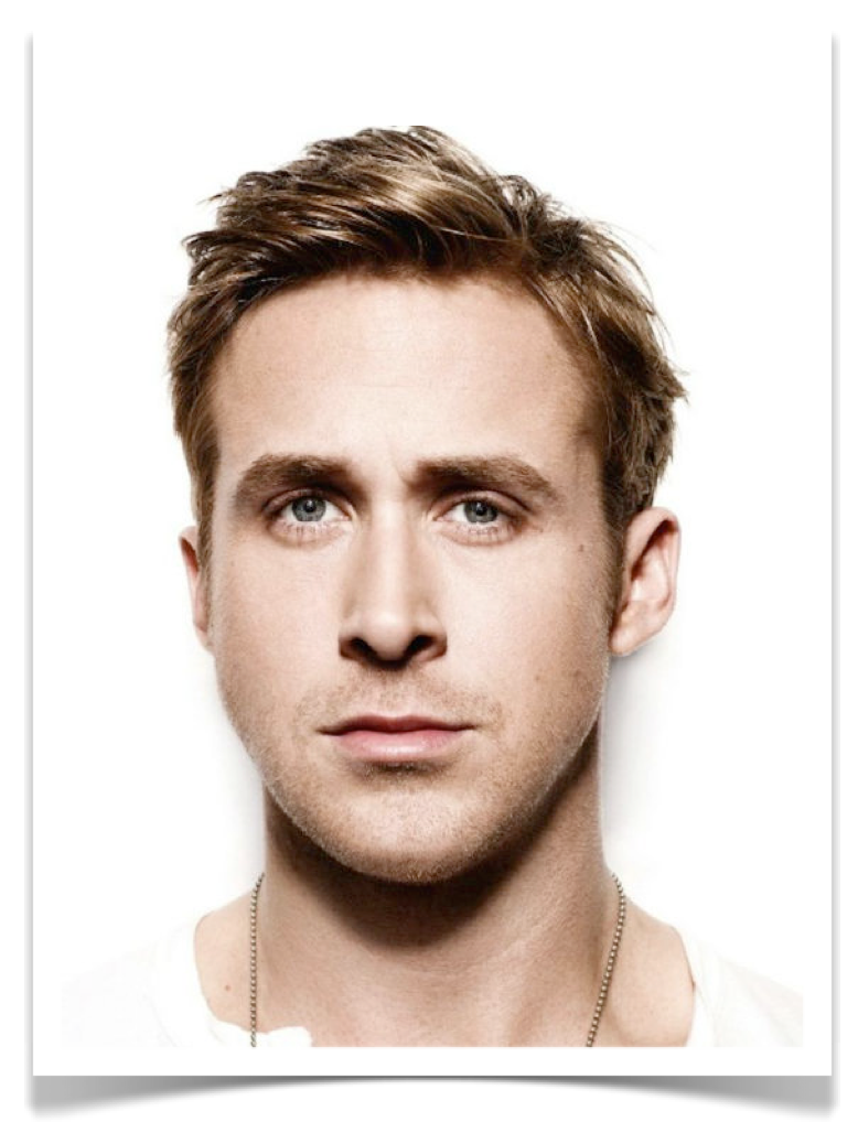 -- Dr. 陳瑞鋒 的 BLOG 二部曲--: 透過 削骨 改善 臉型不對稱 ( Correct facial asymmetry with ...