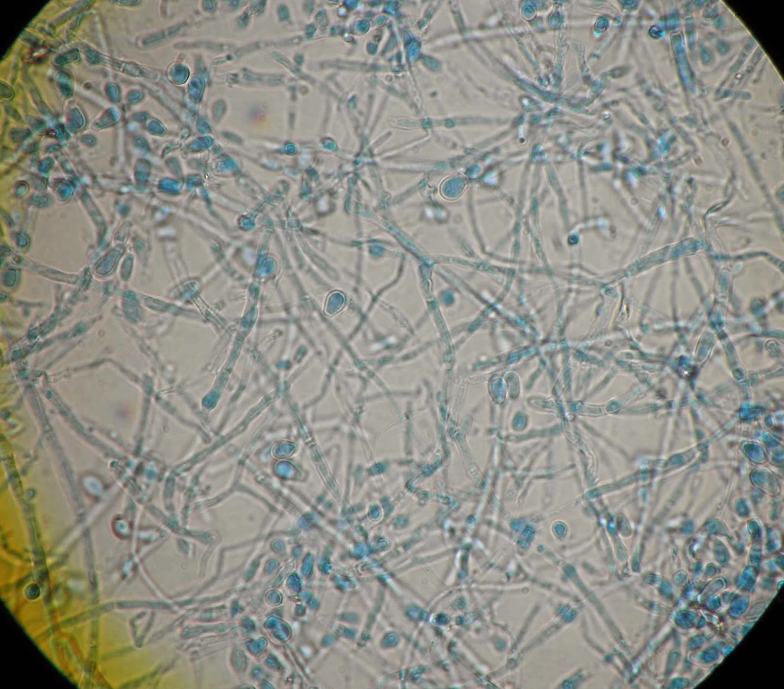 ATLAS MICOLOGIA: CHRYSOSPORIUM KERATINOPHILUM