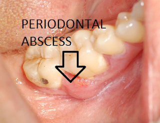 Wellness Lab Health Info: Lymph Nodes in Neck