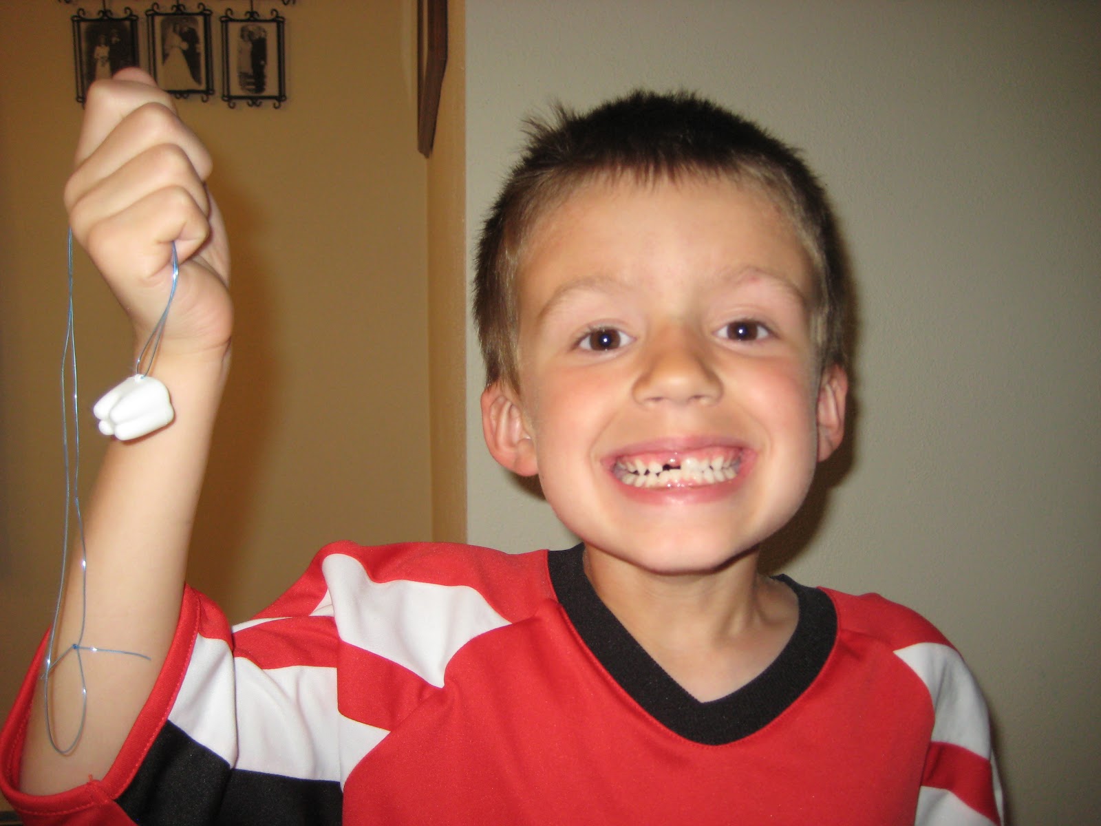 The Fritel Family: Andrew's first tooth loss
