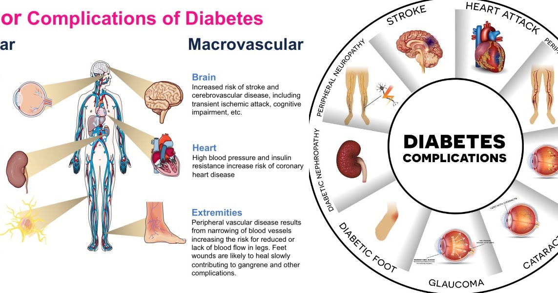 Complications of Diabetes Mellitus That Need Attention