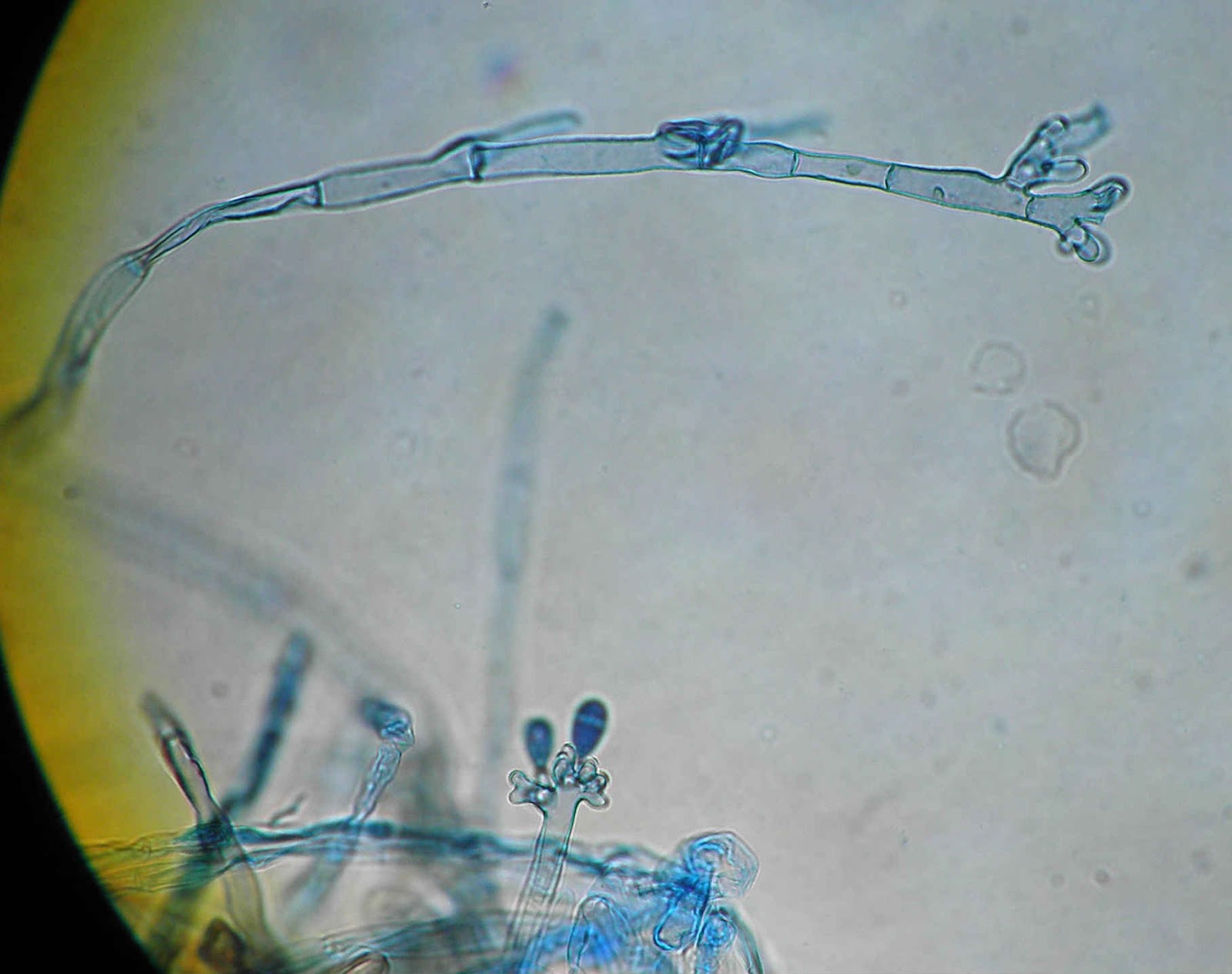 ATLAS MICOLOGIA: dezembro 2015