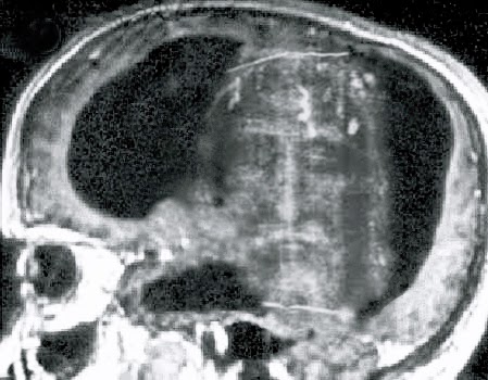 Il Credino: La Sacra Sindrome: L'Anatomia Del Credino