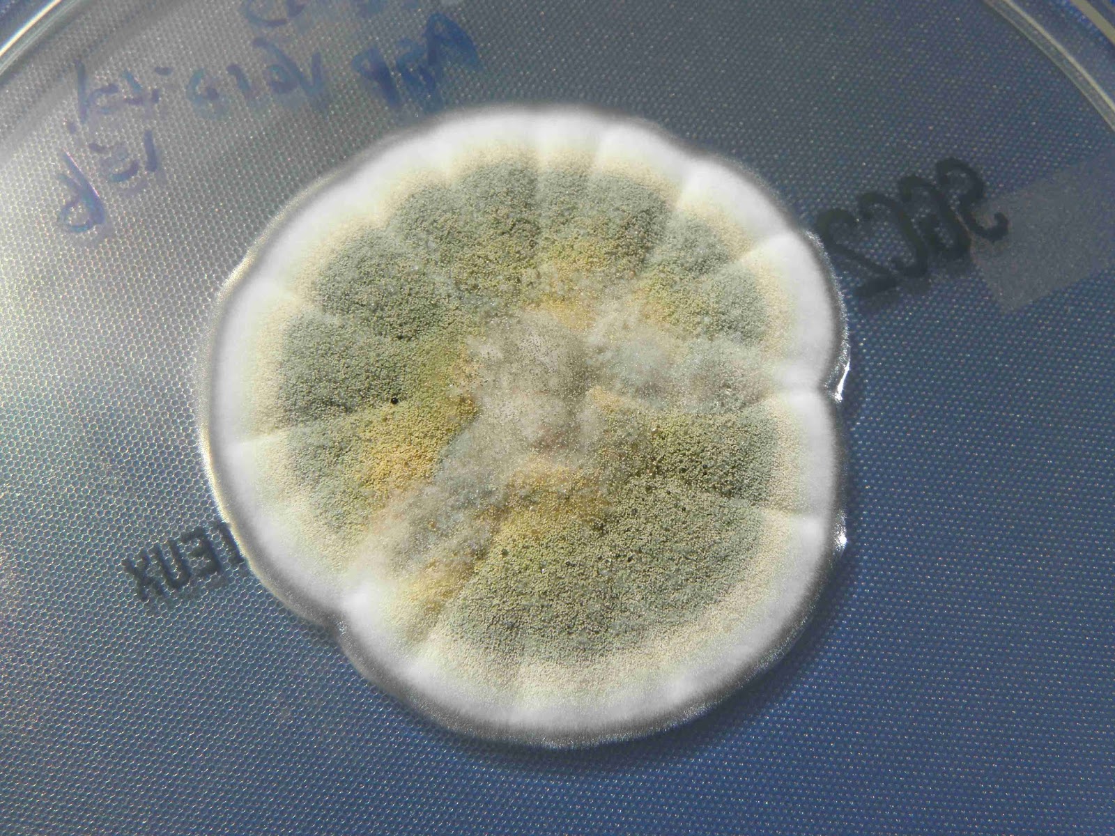 ATLAS MICOLOGIA: ASPERGILLUS VERSICOLOR