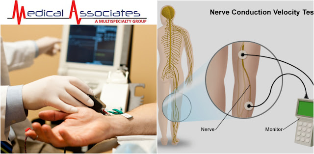 Medical Associates : All that you need to know about NCV test