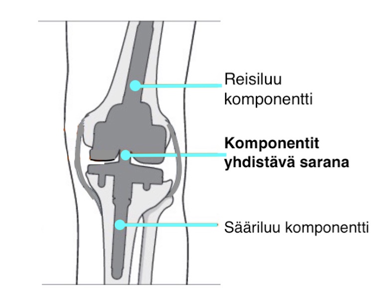 Tules tuo: Saranatekonivel