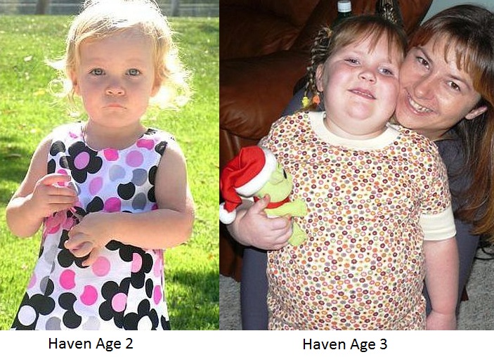 LIFE: Marriage, Kids, Dogs, Chickens, and ROHHAD Syndrome : ROHHAD ...