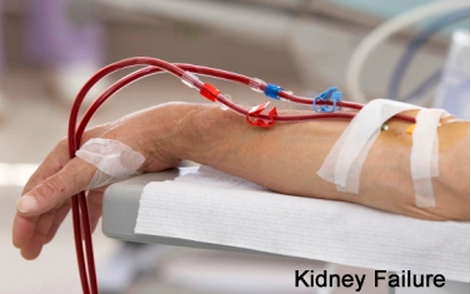 Menggigil Dan Demam Saat Hemodialisis - Pasien Sehat