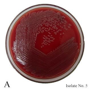 MICROBIOLOGY BLOG FOR STUDENTS (MBLOGSTU): Cultural and Biochemical ...