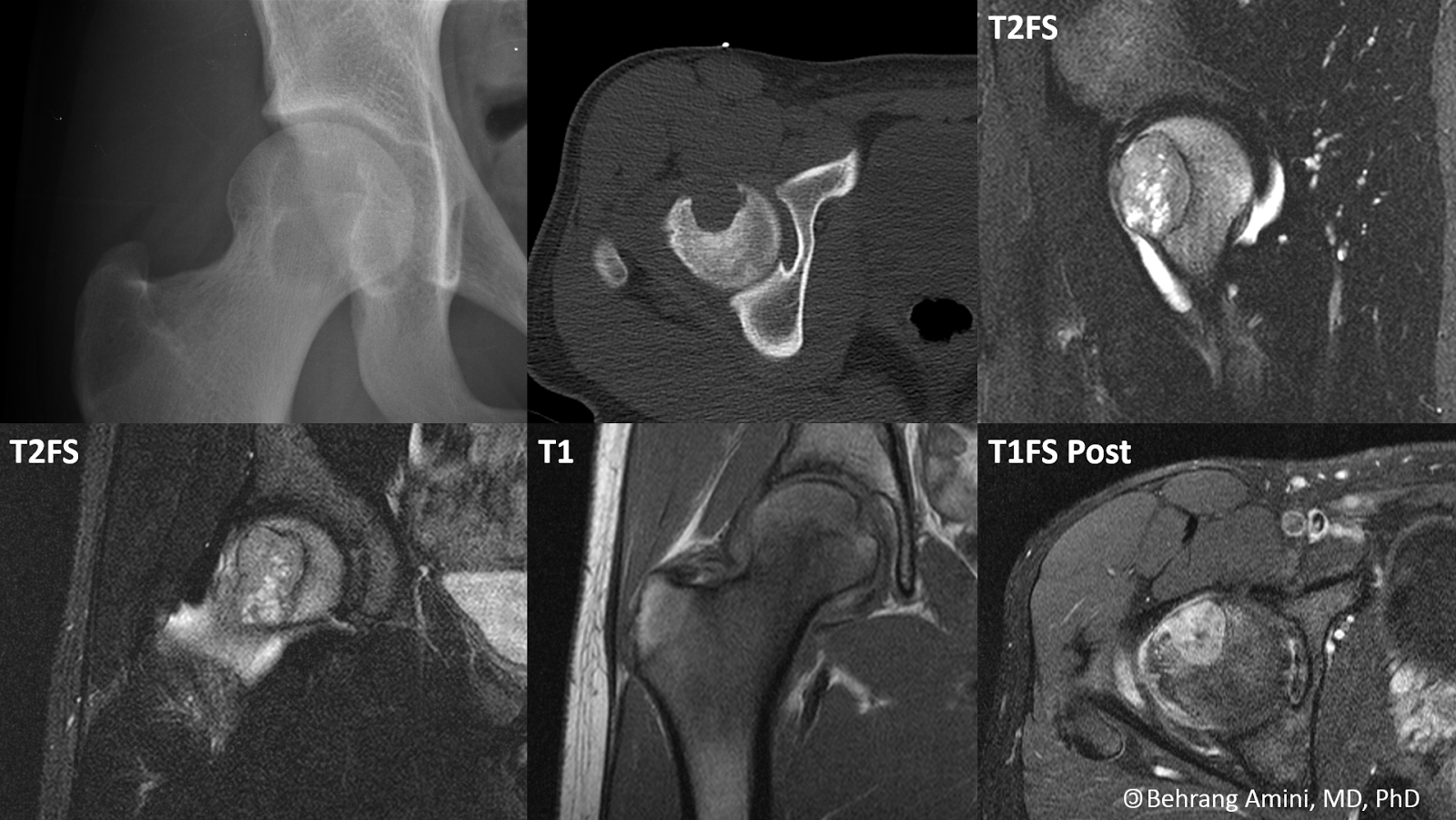 Roentgen Ray Reader: 2017