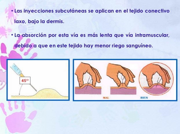 Laboratorista Clínico Majos: Tipos de Punción