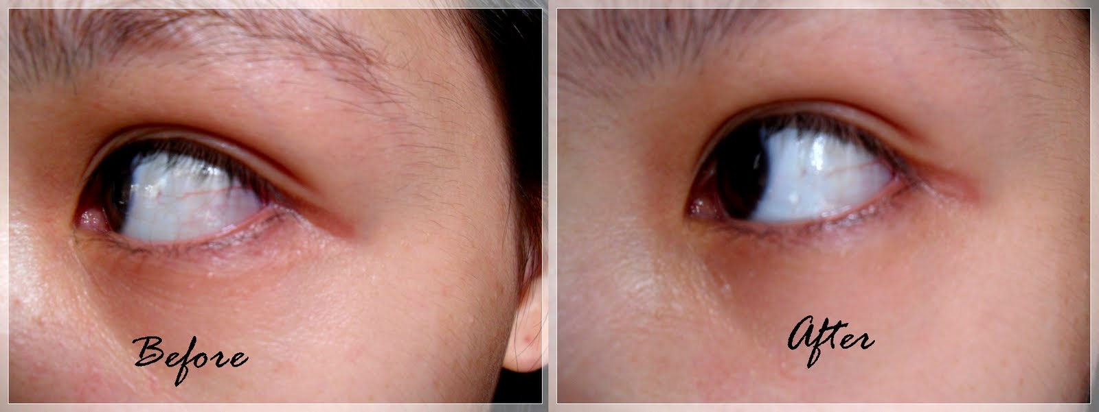 How to Reduce Eye Strain And Redness | FashionForLife1