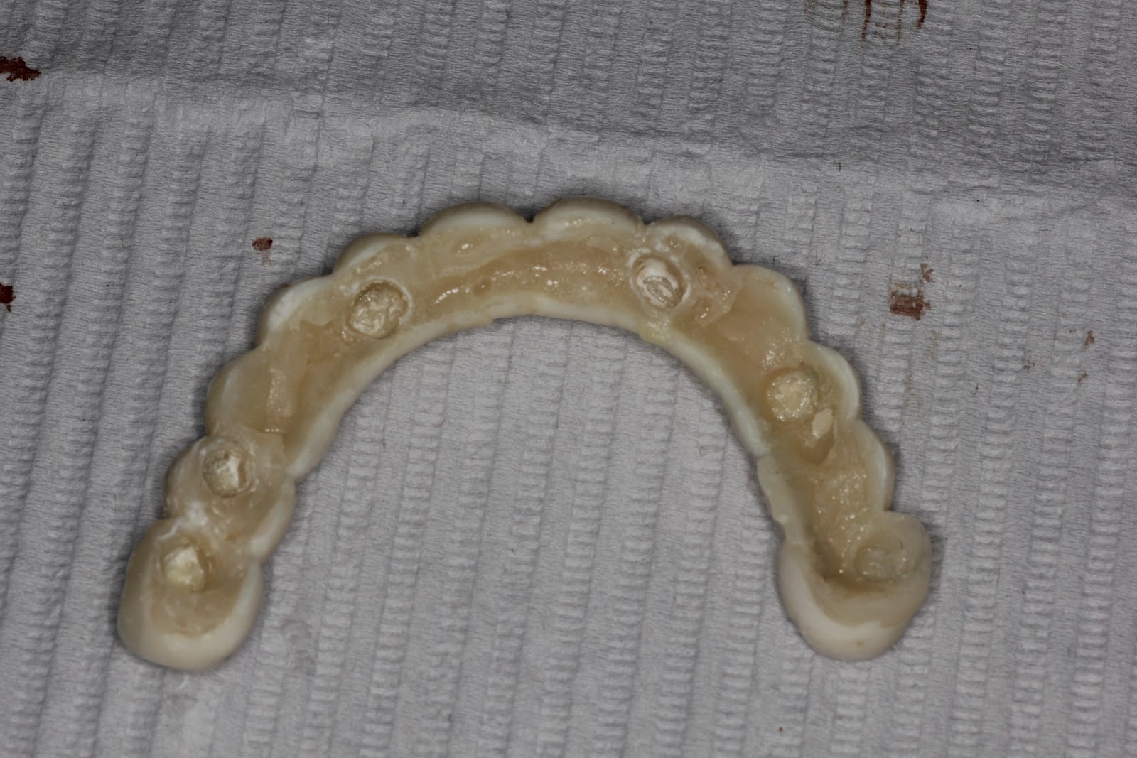 The DMD and MDT Learning Blog: New Materials, New Methods, Patient Wins ...