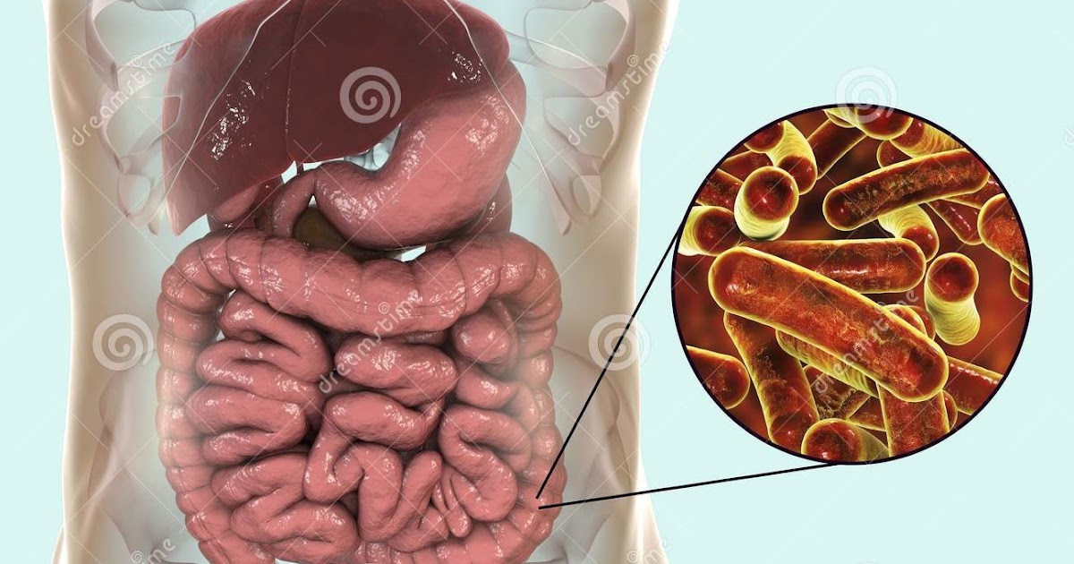 What Is Dysentery? - Teroes