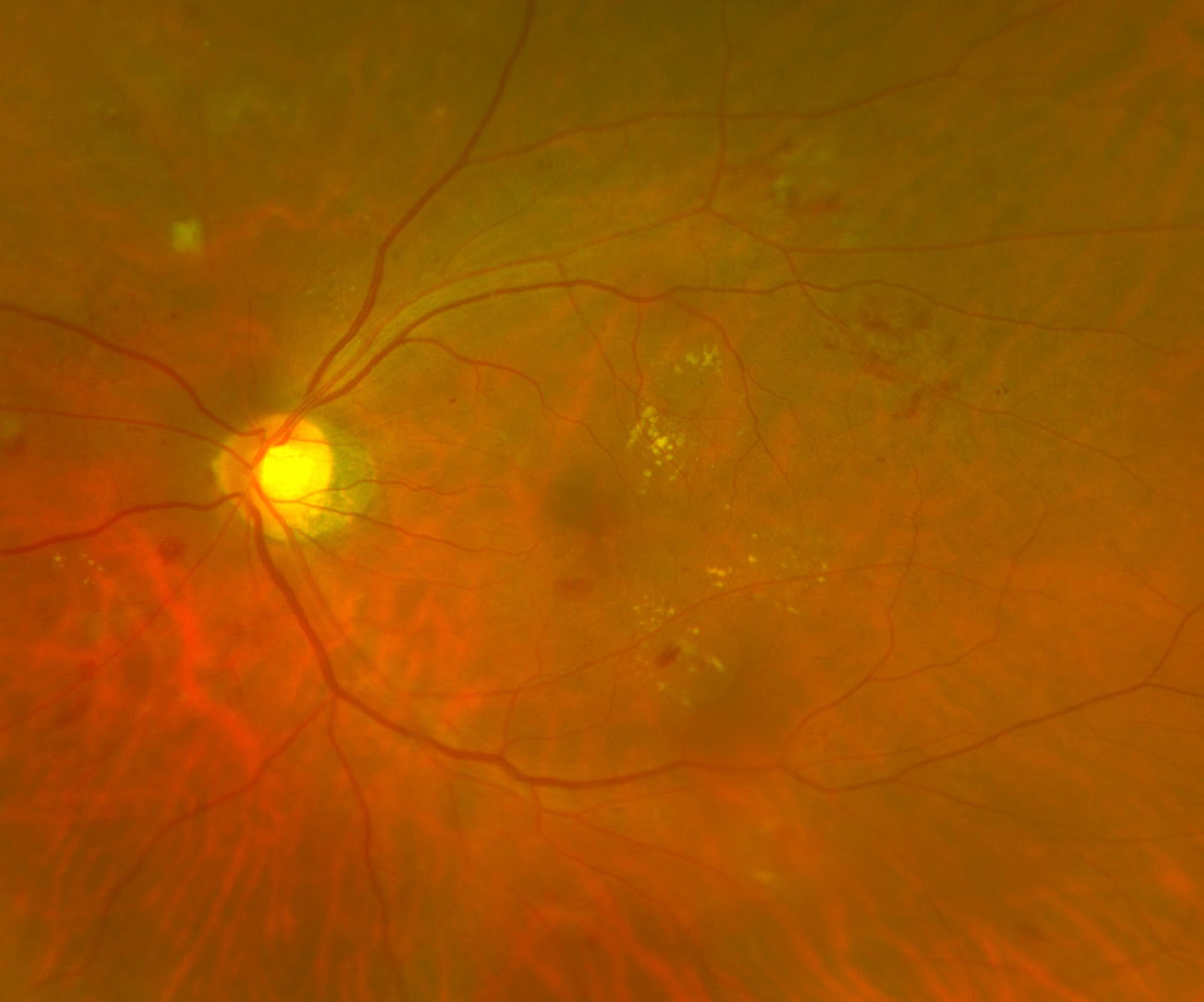 All things eye | Por Yong Ming: Medical conditions which show up in the eye