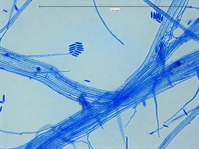 Fun With Microbiology (What's Buggin' You?): Sarocladium kiliense