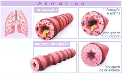 Cuando el suspiro se vuelve un desafío: Percepción de la disnea durante ...