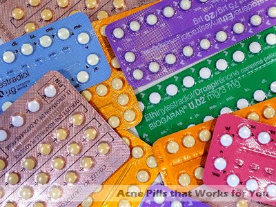 Choosing the Acne Pills that Works for You | Hormonal Acne Tips