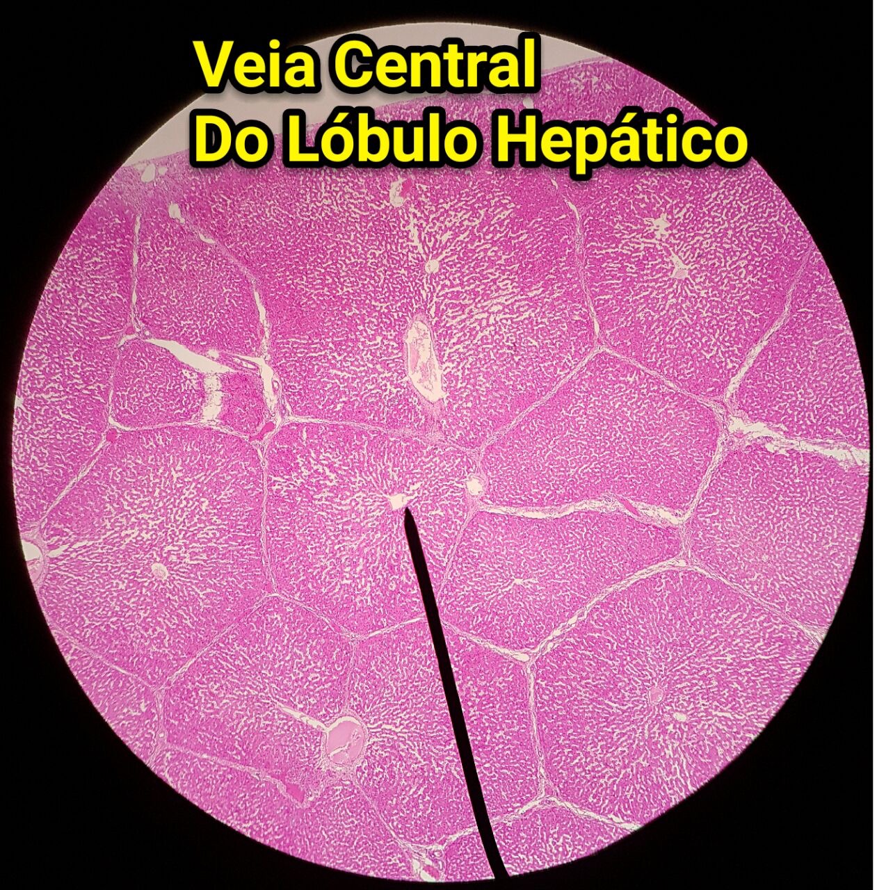 HISTOLOGIA90: HISTOLOGIA DO FÍGADO E DA VESÍCULA BILIAR