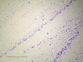 Microscope World Blog: Sarcina under the Microscope