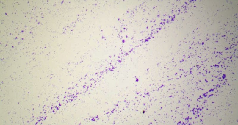 Cocci Bacteria Under Microscope