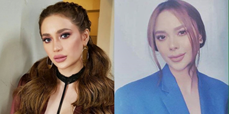 5 Artists Who Admitted To Have Undergone Plastic Surgery - News Info PH