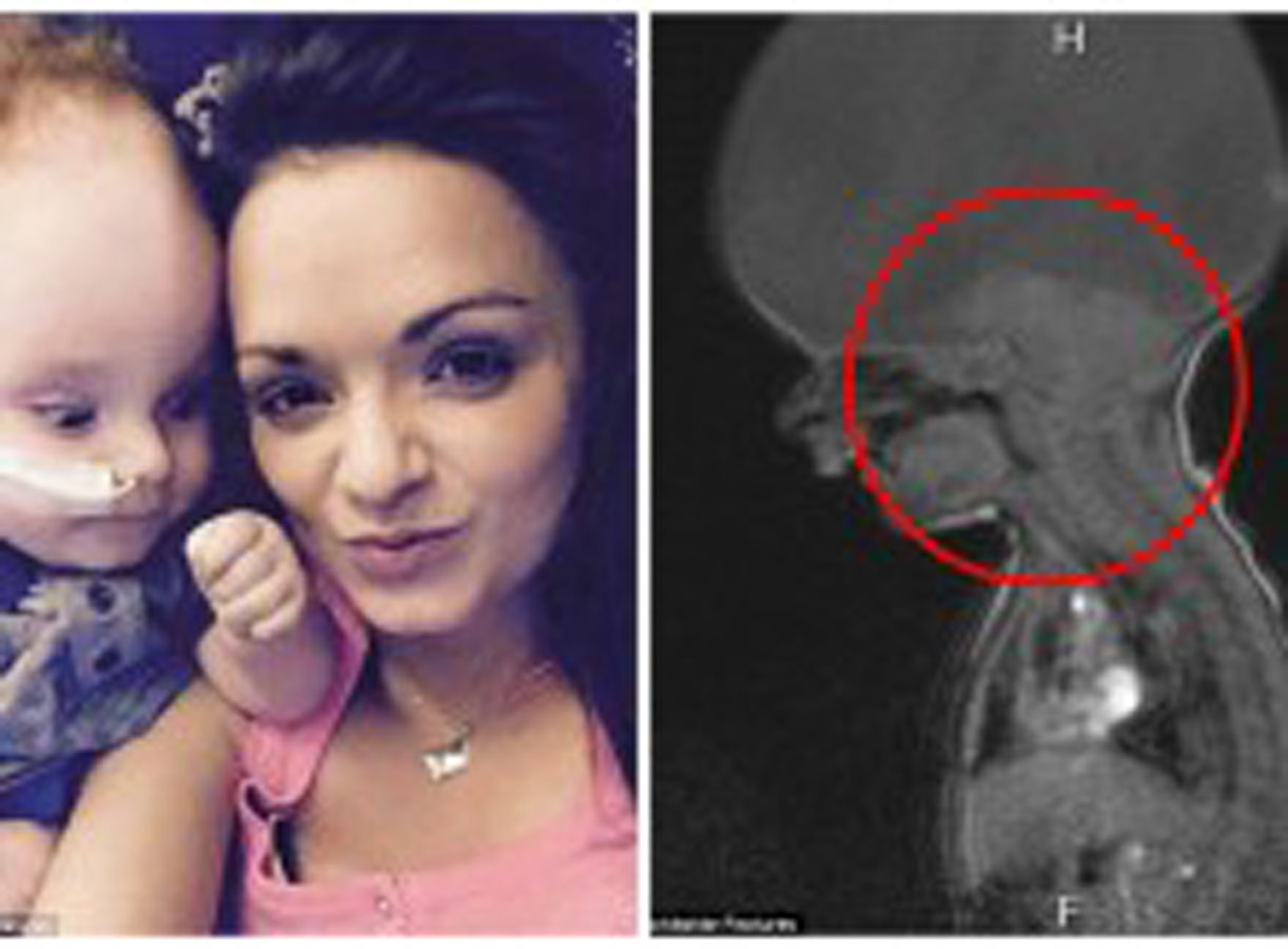 HE WAS BORN WITHOUT BRAIN BUT HE DID SOMETHING AMAZING ON HIS SECOND ...