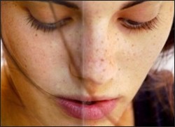 Natural Tips Eliminate Black Flecks on Skin Face